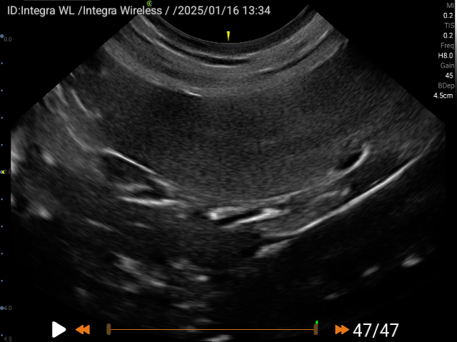 Integra Wireless | Core Imaging